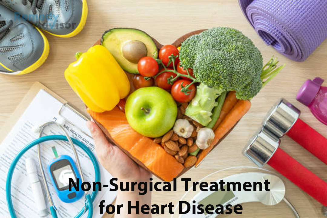 Non-Surgical Treatment for Heart Disease – Remedy Advisor