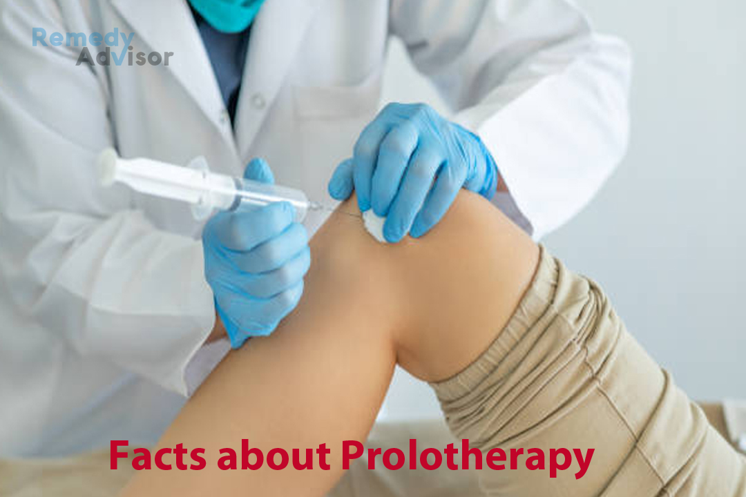 Facts about Prolotherapy – Remedy Advisor