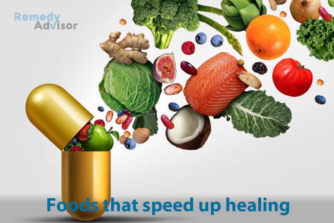 Foods that speed up healing – Remedy Advisor