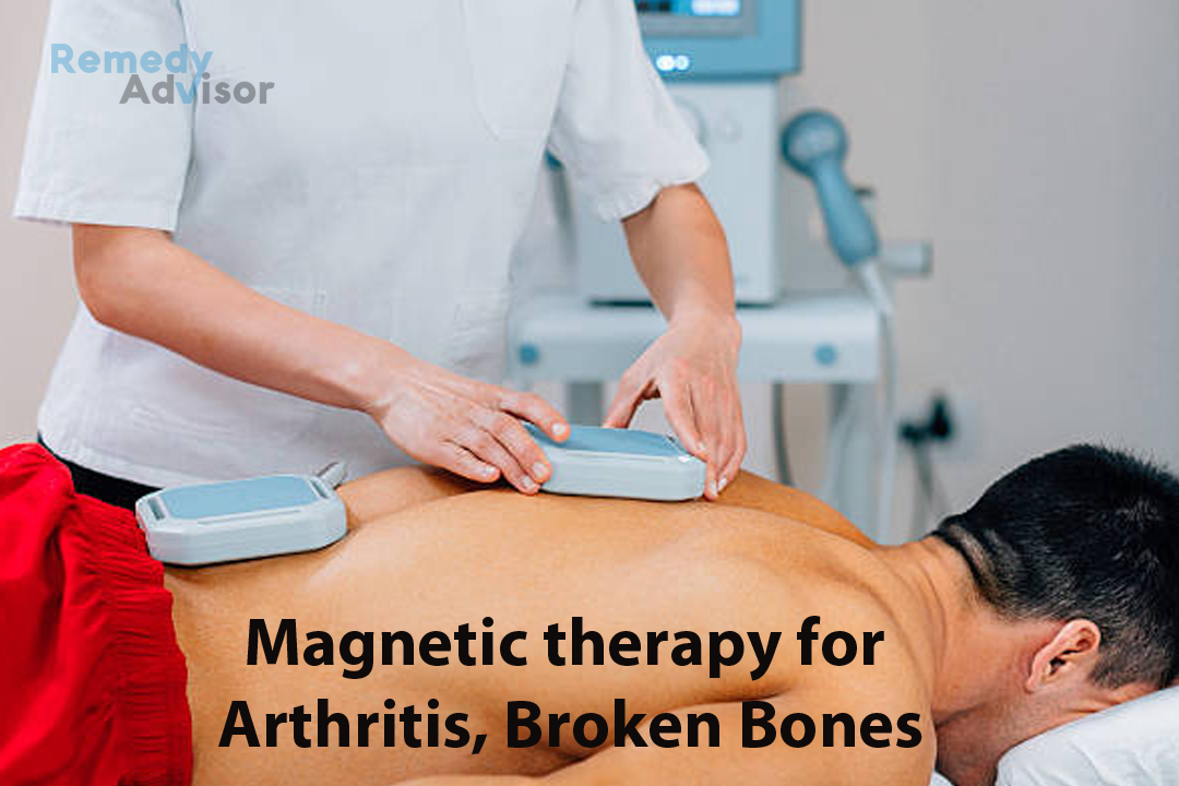 Magnetic therapy for Arthritis, Broken Bones and More – Remedy Advisor