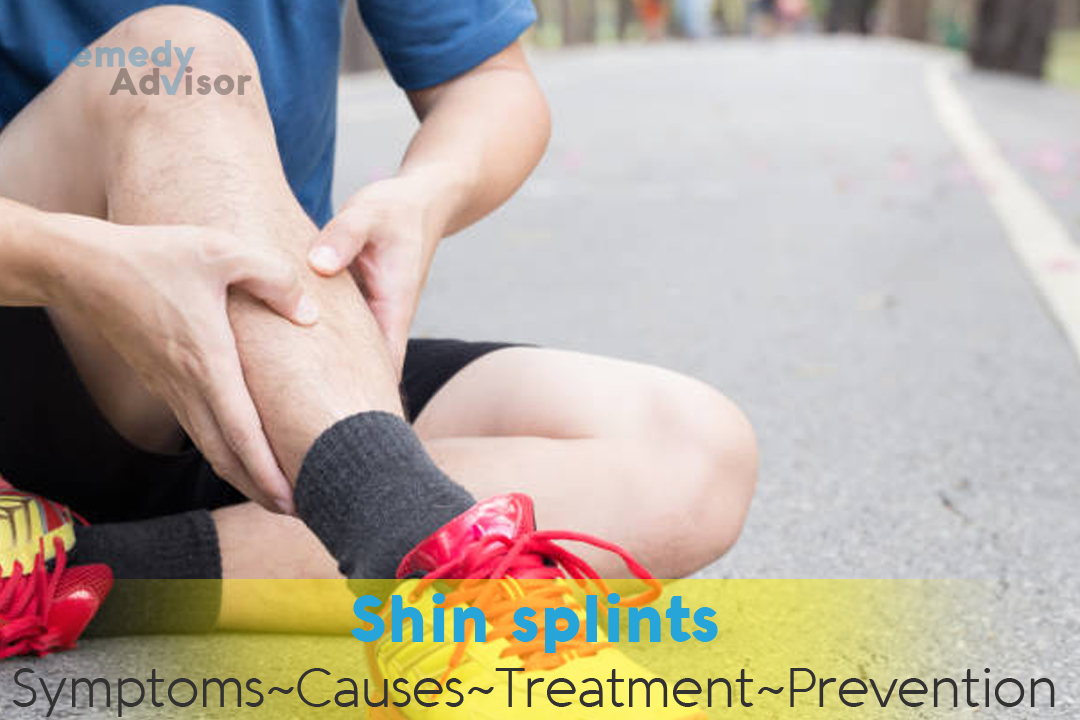 Shin splints – Remedy Advisor